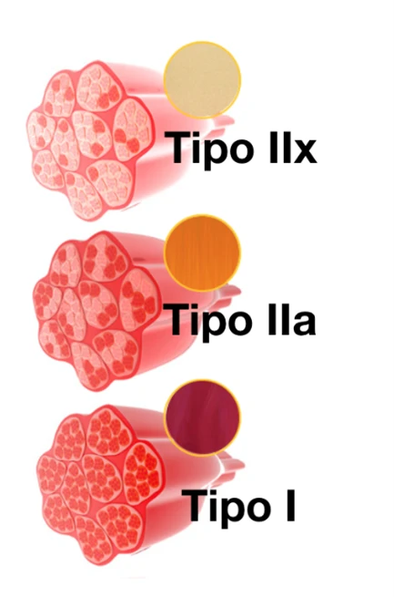 Sarcopenia: cos'è e come riconoscerla e come curarla